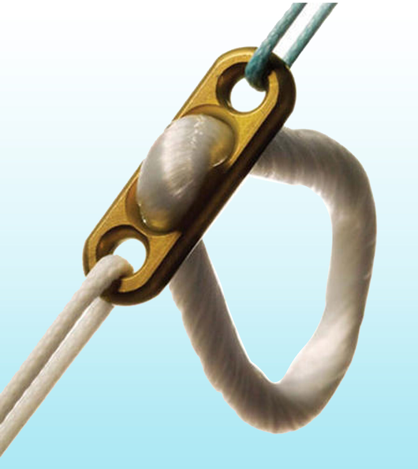 Endo Button with loop - Bond Well Ortho